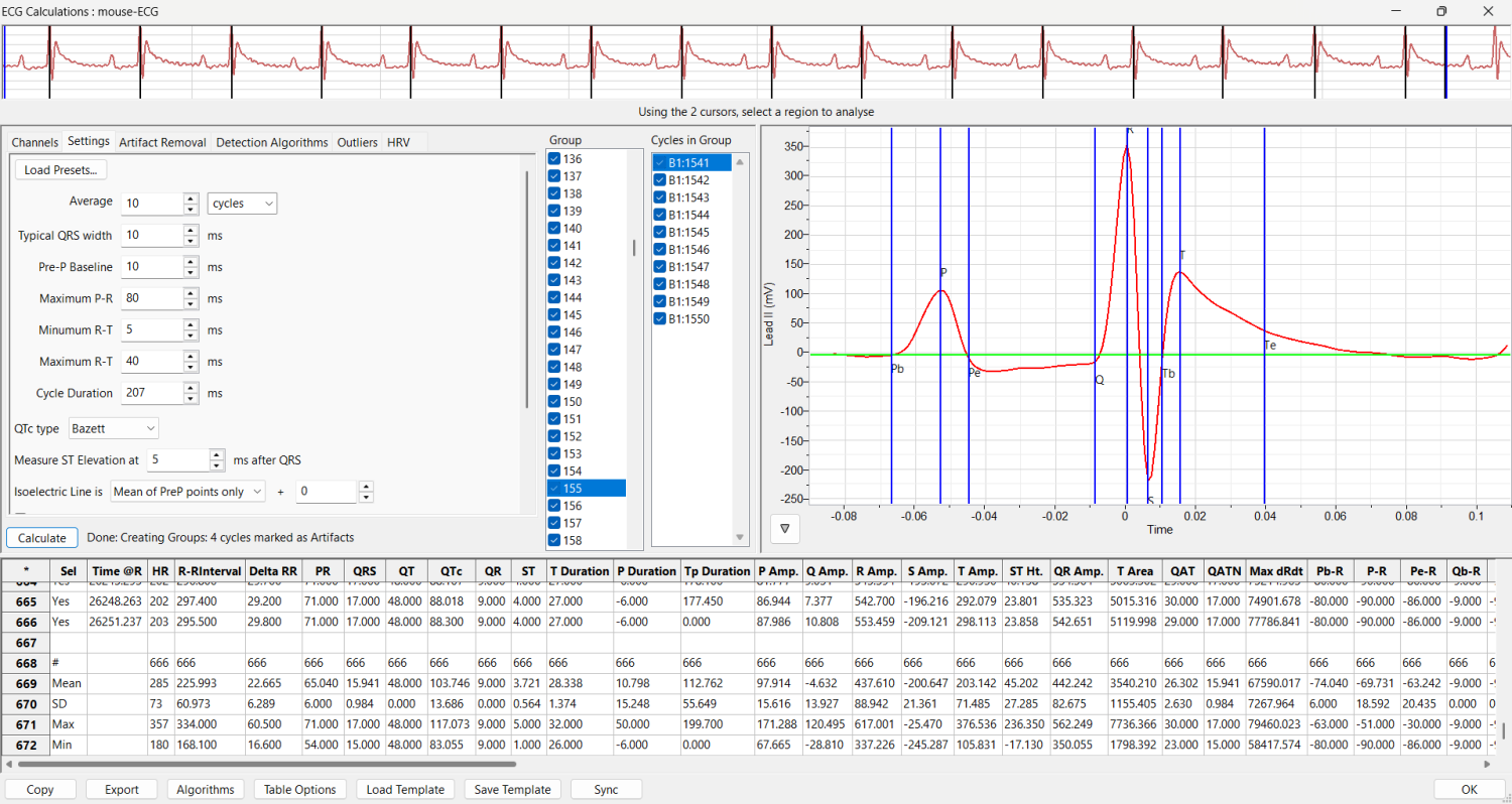 LabScribe ECG Analysis Module - iWorx Systems, Inc.