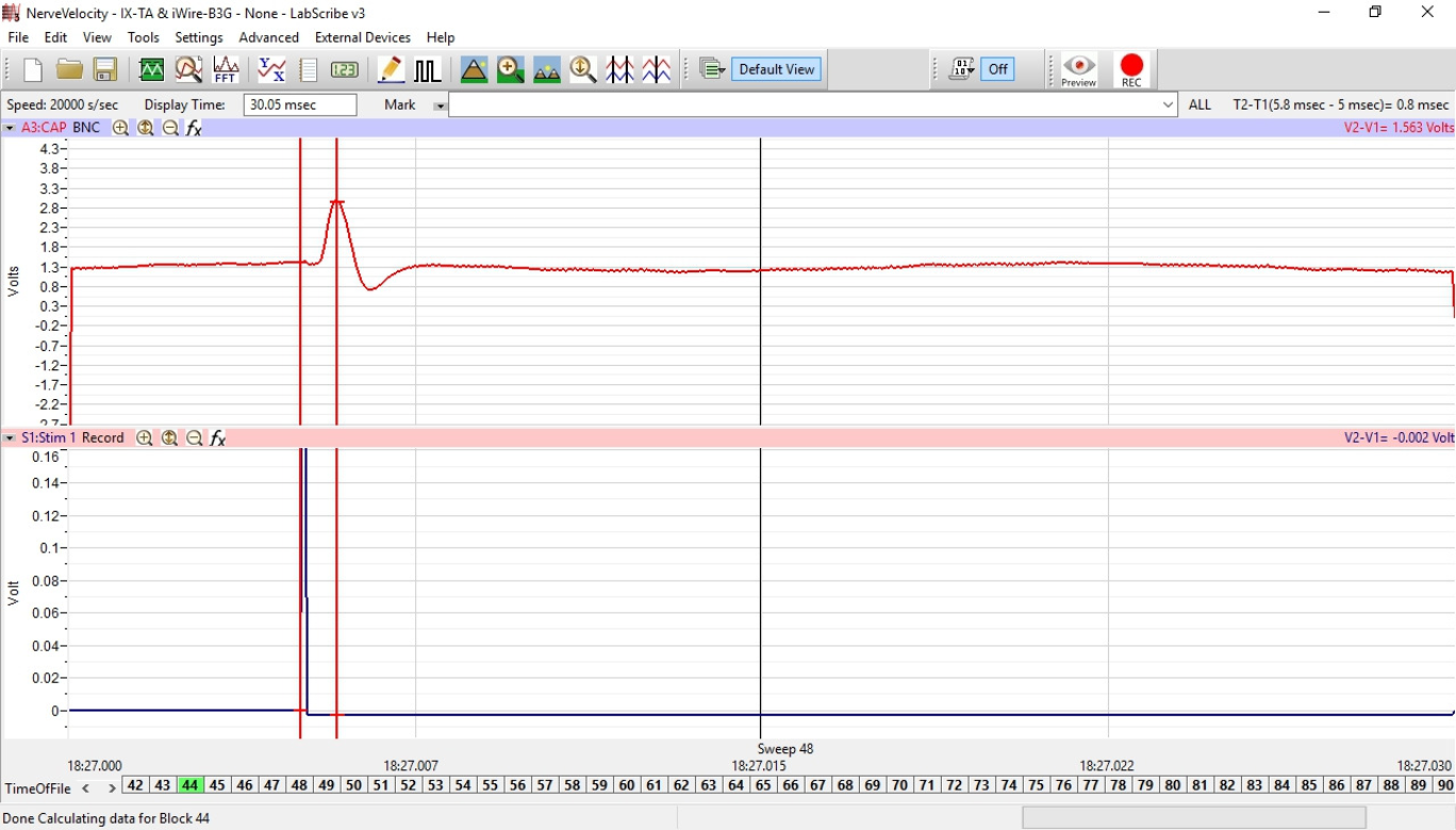 Action Potential Landing Page - iWorx Systems, Inc.