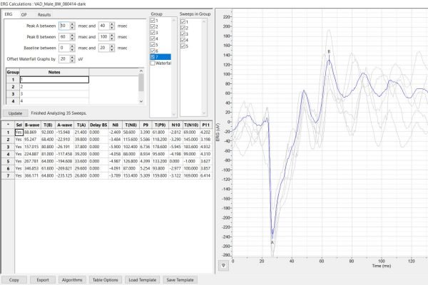LabScribe ERG Analysis Module - iWorx Systems, Inc.