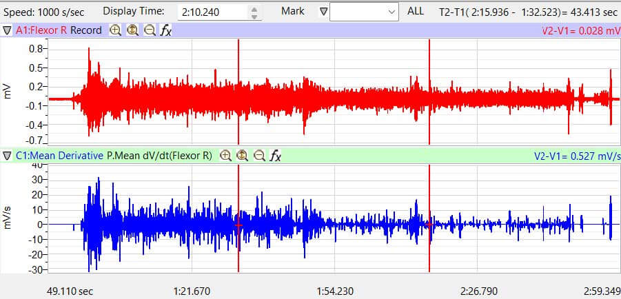 EMG Analysis Using LabScribe - iWorx Systems, Inc.