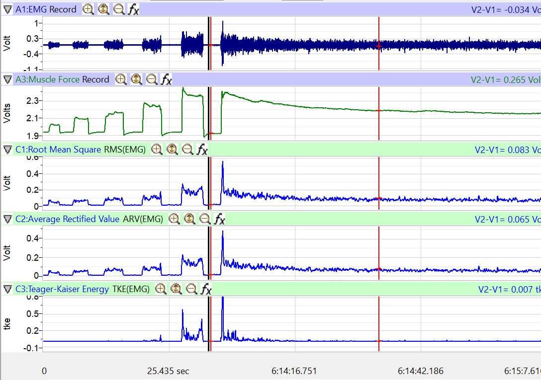 Emg Analysis Using Labscribe Iworx Systems Inc