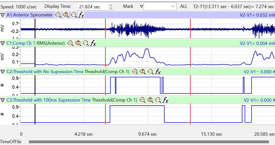 EMG Analysis Using LabScribe - iWorx Systems Inc EMG Analysis Using LabScribe - iWorx Systems Inc