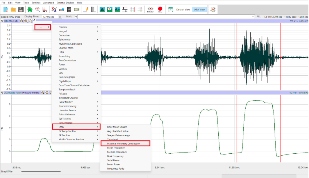 EMG: Normalizing to Maximal Voluntary Contraction (MVC) - iWorx Systems, Inc.
