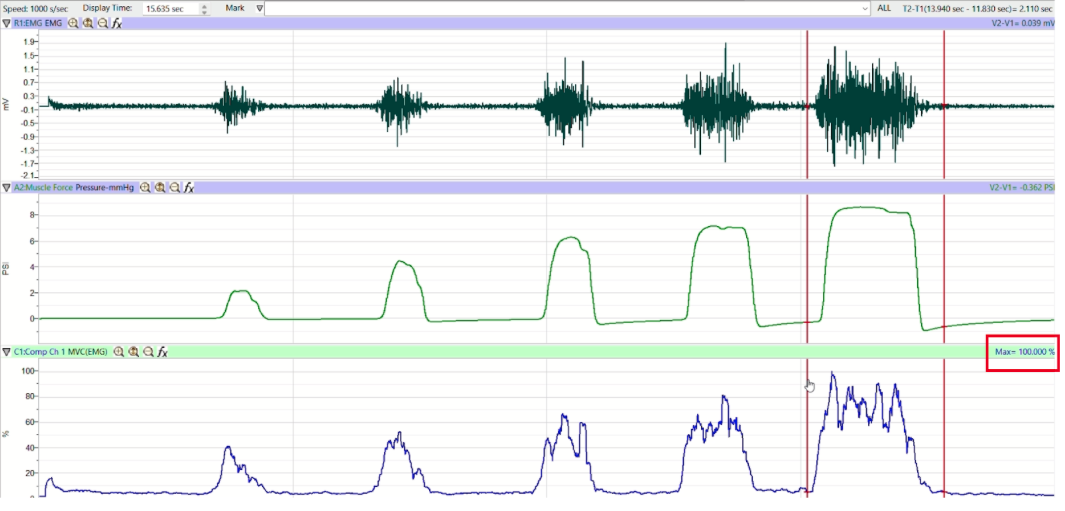 EMG: Normalizing to Maximal Voluntary Contraction (MVC) - iWorx Systems ...