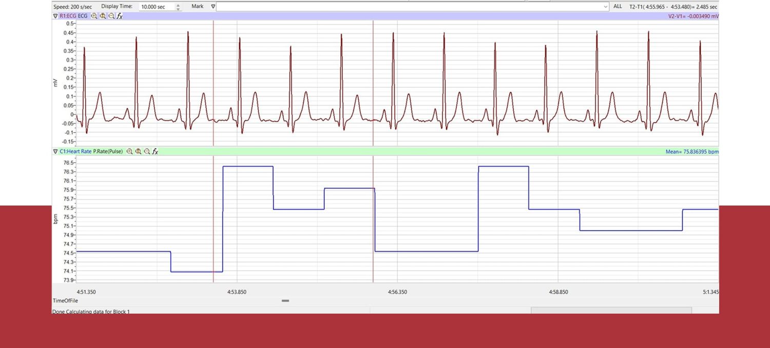 Case Studies – ECG Decoding and Analysis - iWorx Systems Inc